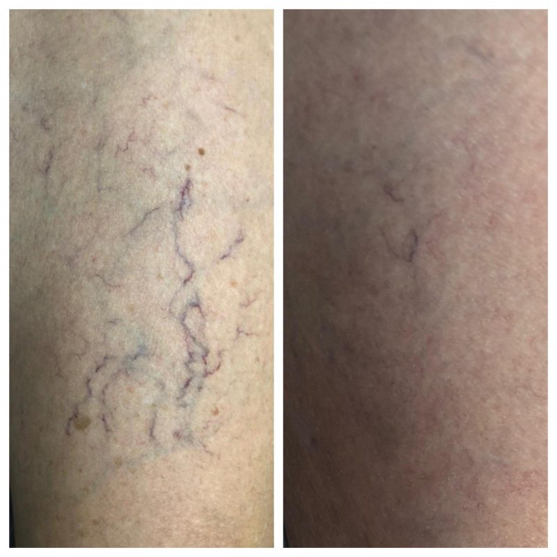 Galería – NOVARICES